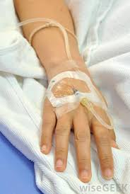 When were IV fluids invented? – Healthfacts.blog